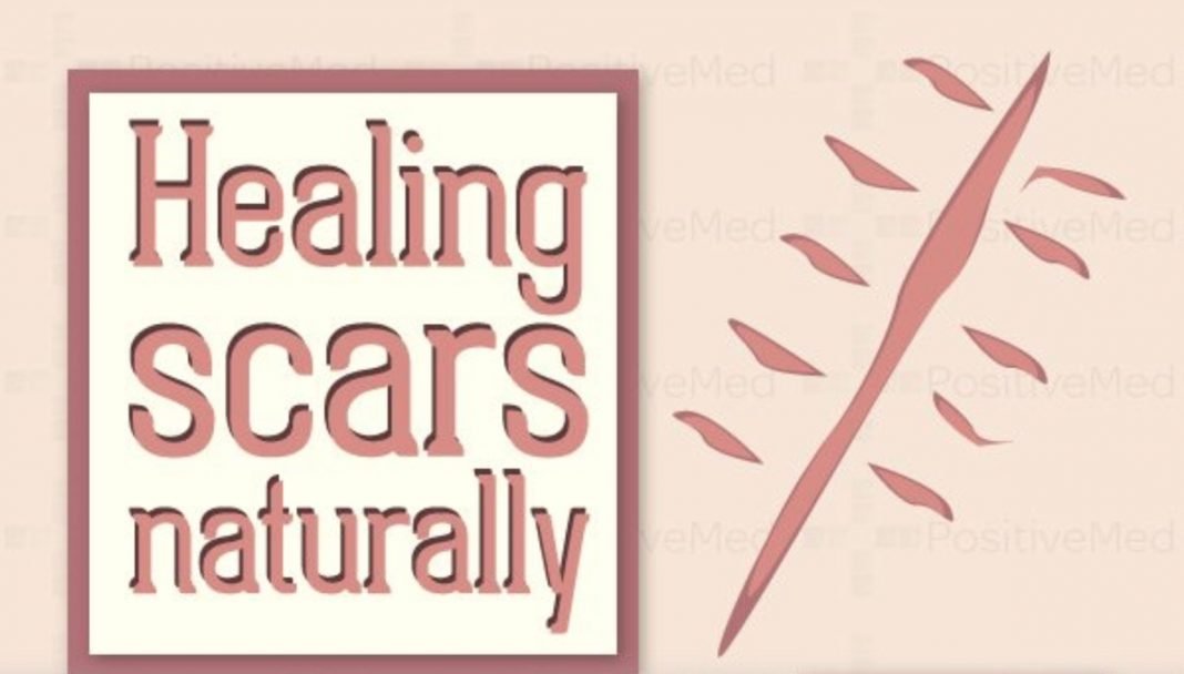 5 Facts You Need Know About Scars and How to Get Rid of Them