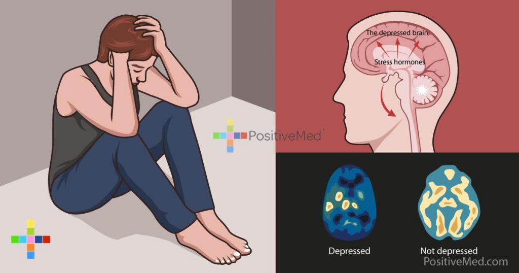 This Is What Happens To Your Brain And Memory When You're Depressed