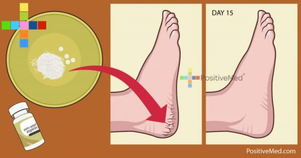 Simple Method to Solve Your Foot Problems - PositiveMed