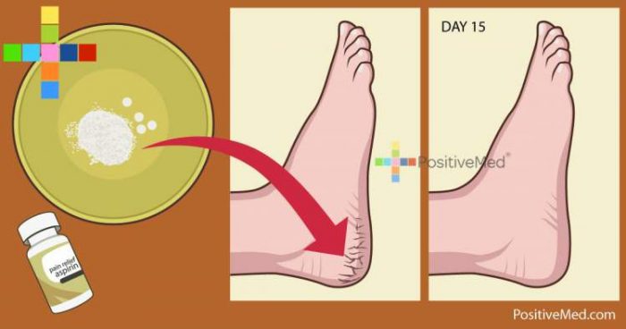 Simple Method to Solve Your Foot Problems - PositiveMed