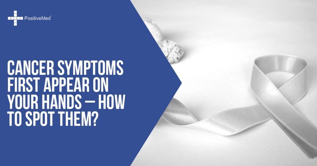 Cancer Symptoms First Appear On Your Hands - How to Spot Them ...