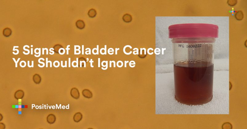 5 Signs of Bladder Cancer You Shouldn't Ignore - PositiveMed