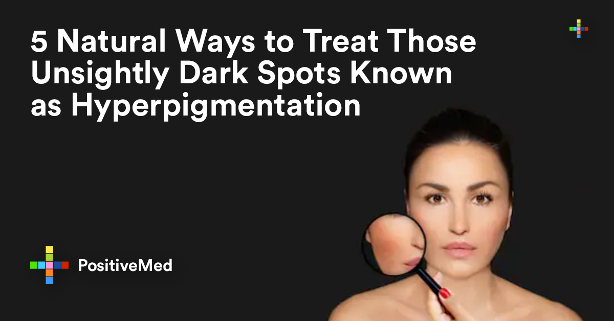 5 Natural Ways to Treat Those Unsightly Dark Spots Known as ...