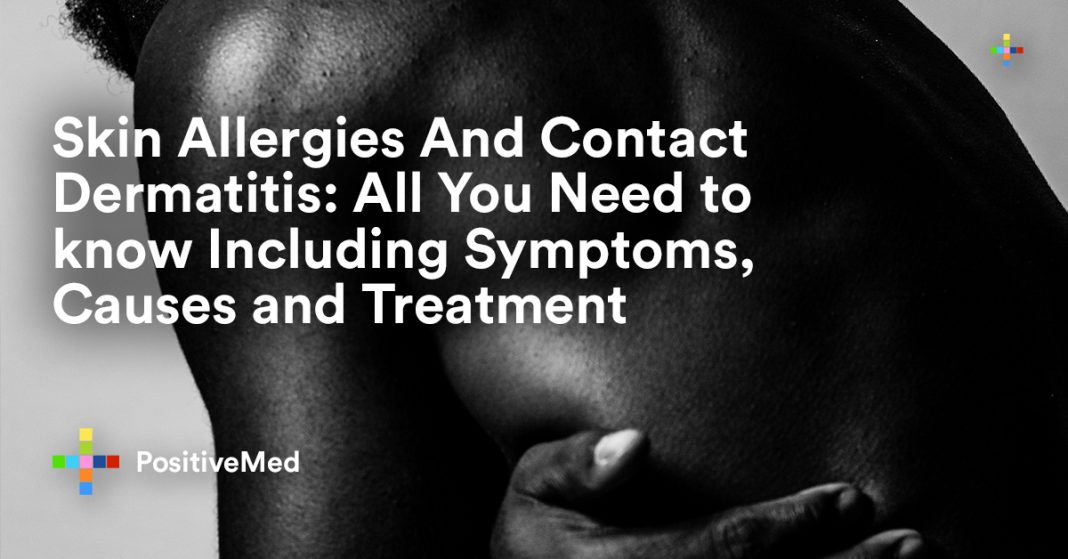 Skin Allergies And Contact Dermatitis: All You Need to know Including ...