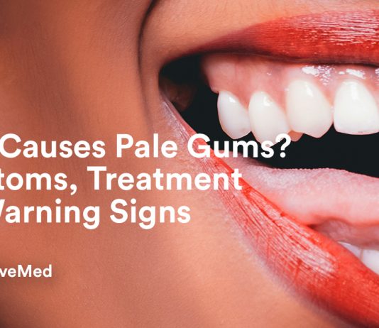 Oral Health Archives - PositiveMed