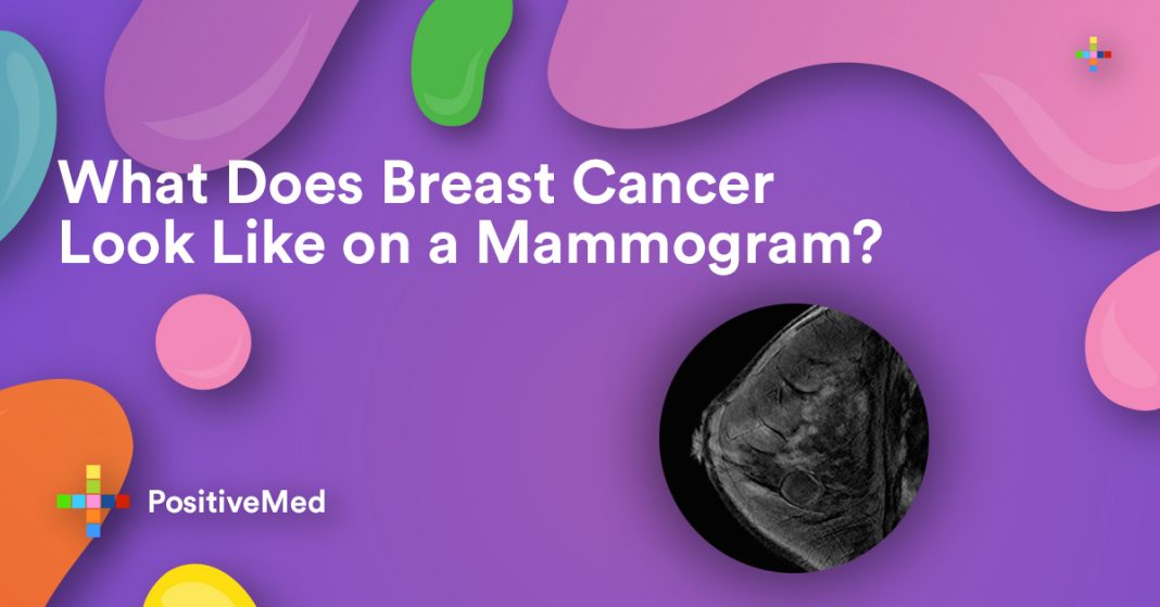 What Does Breast Cancer Look Like on a Mammogram? - PositiveMed