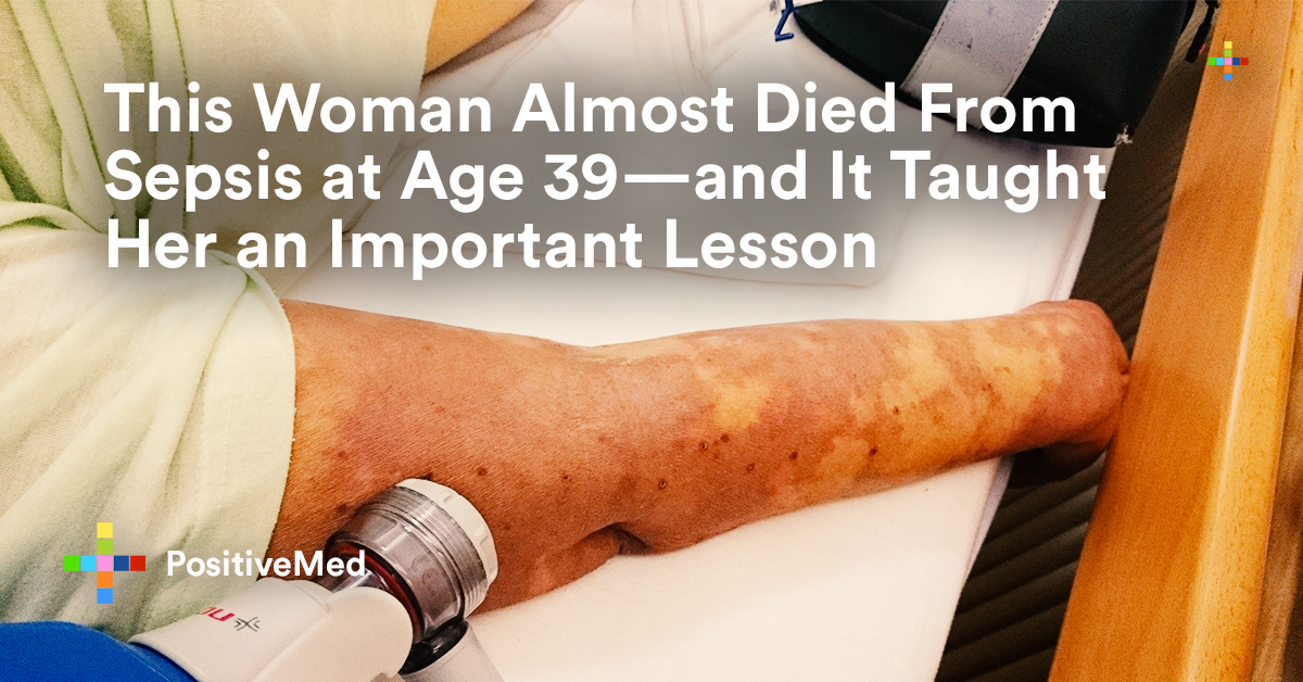 This Woman Almost Died From Sepsis at Age 39—and She Learned an ...