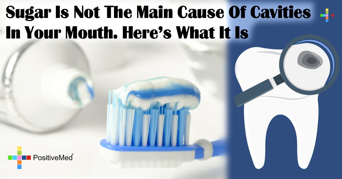 Sugar Is Not The Main Cause Of Cavities In Your Mouth. Here's What It ...