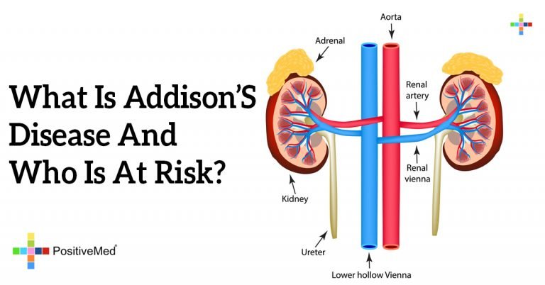 What Is Addison's Disease and Who Is at Risk? - PositiveMed
