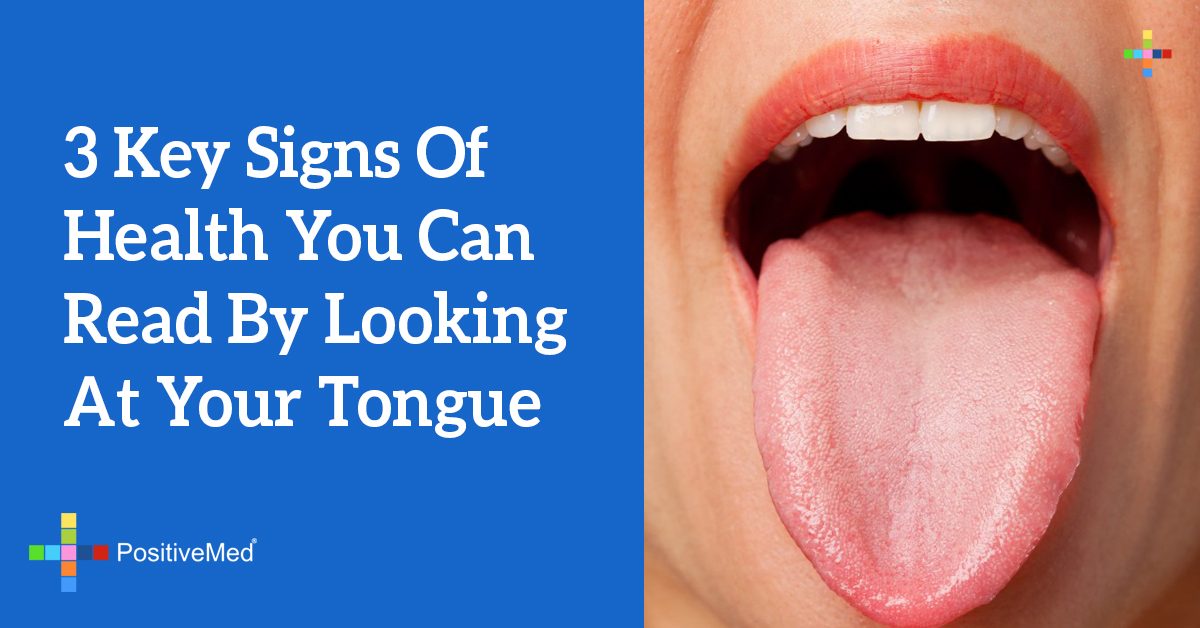 3-Key-Signs-Of-Health-You-Can-Read-By-Looking-At-Your-Tongue - PositiveMed