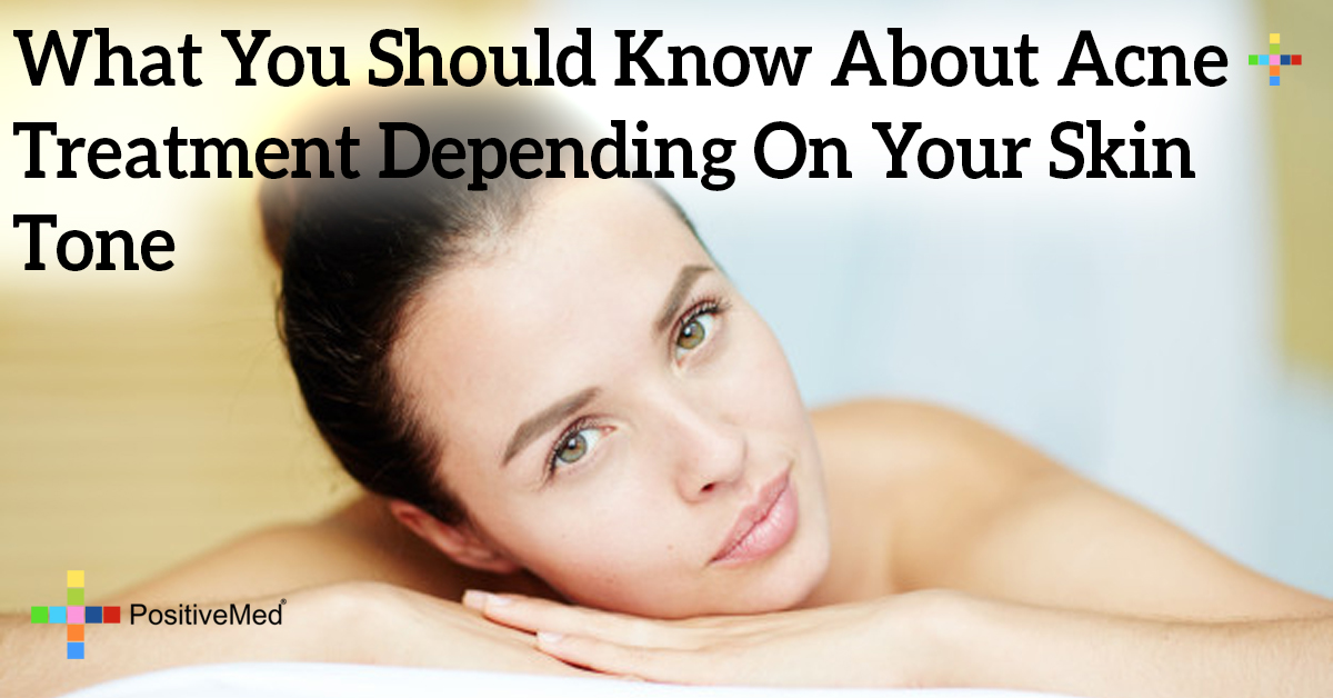 What You Should Know About Acne Treatment Depending On Your Skin Tone ...