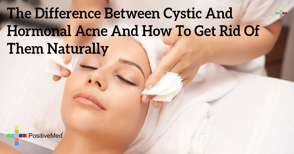 The Difference Between Cystic And Hormonal Acne And How To Get Rid Of