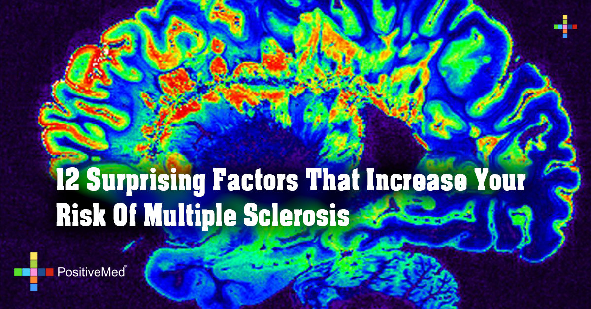 12 Surprising Factors That Increase Your Risk Of Multiple Sclerosis