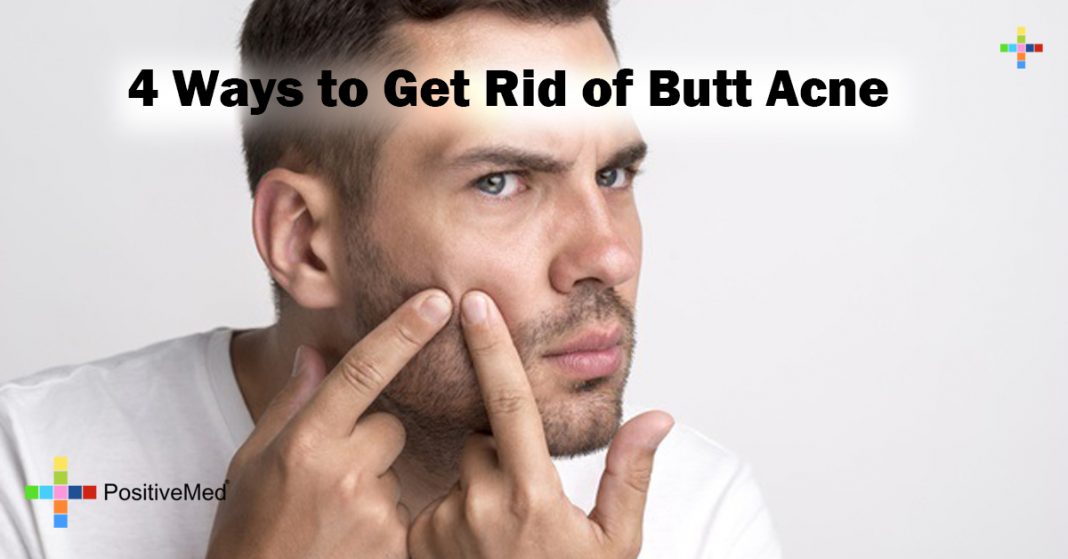 4 Ways to Get Rid of Butt Acne