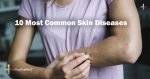 10 Most Common Skin Diseases