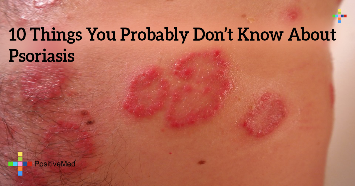 10 Things You Probably Dont Know About Psoriasis