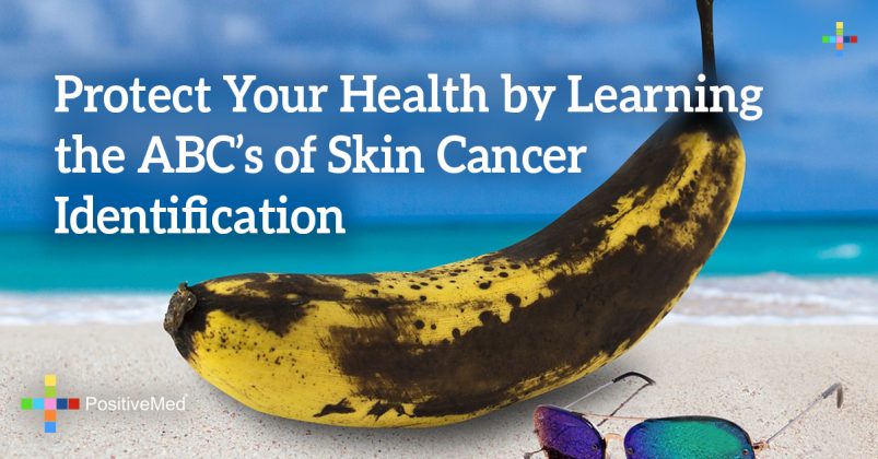 Protect Your Health by Learning the ABC's of Skin Cancer Identification