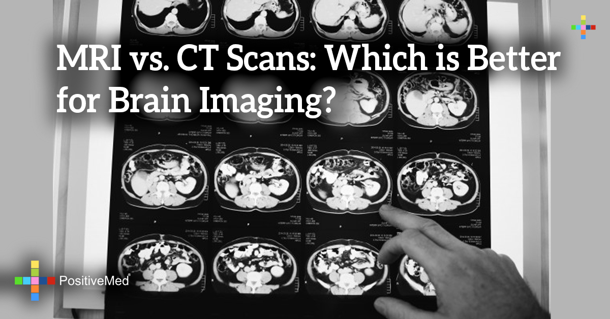 MRI Vs CT Scans Which Is Better For Brain Imaging 