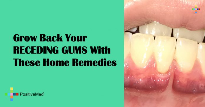 Grow Back Your RECEDING GUMS With These Home Remedies - PositiveMed