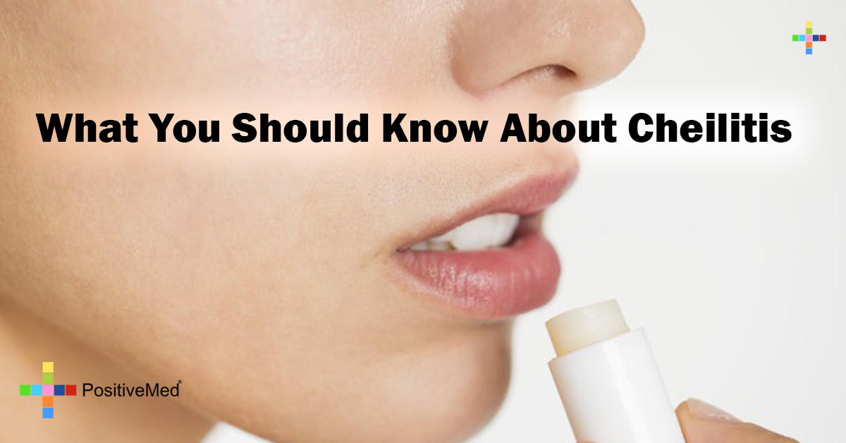 What You Should Know About Cheilitis - PositiveMed