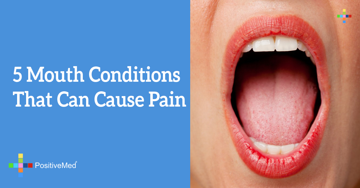 5 Mouth Conditions That Can Cause Pain 5-mouth-conditions-that-can-cause-pain