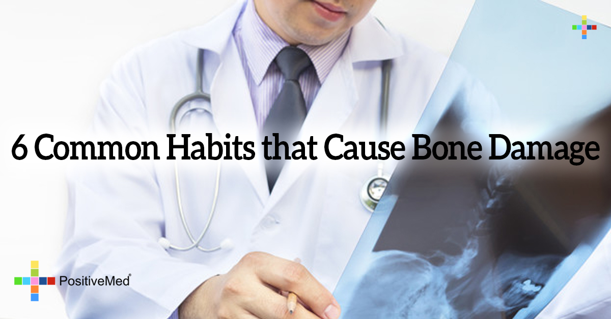 6 Common Habits that Cause Bone Damage - PositiveMed