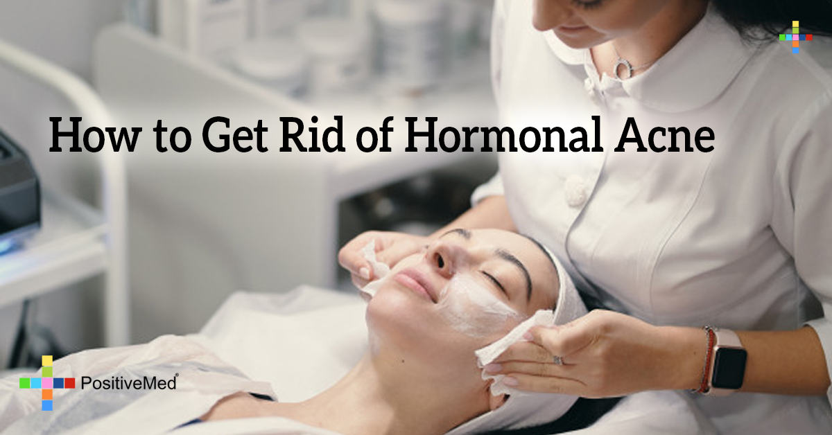 How to Get Rid of Hormonal Acne - PositiveMed