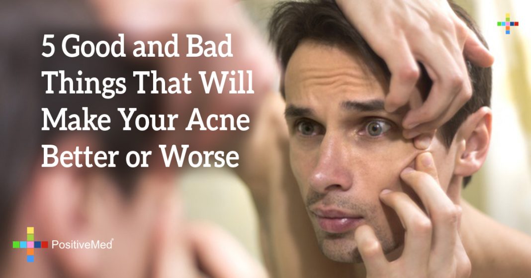 5 Good and Bad Things That Will Make Your Acne Better or Worse ...