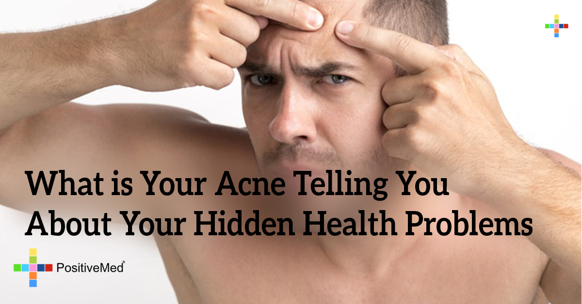 See What Your Acne Can Tell You About Your Health