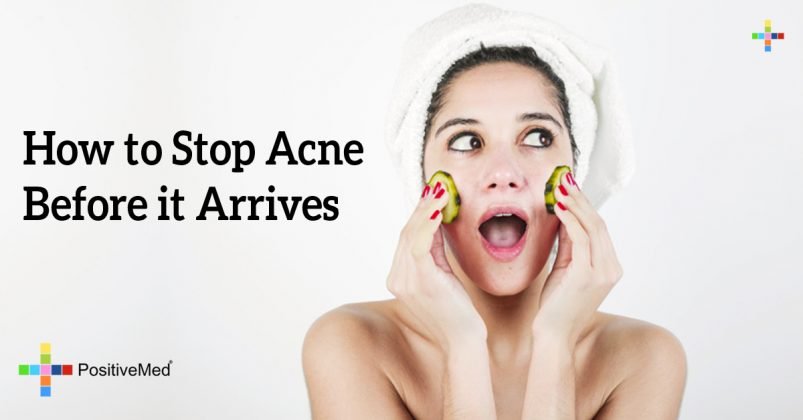 How To Stop Acne Before It Arrives
