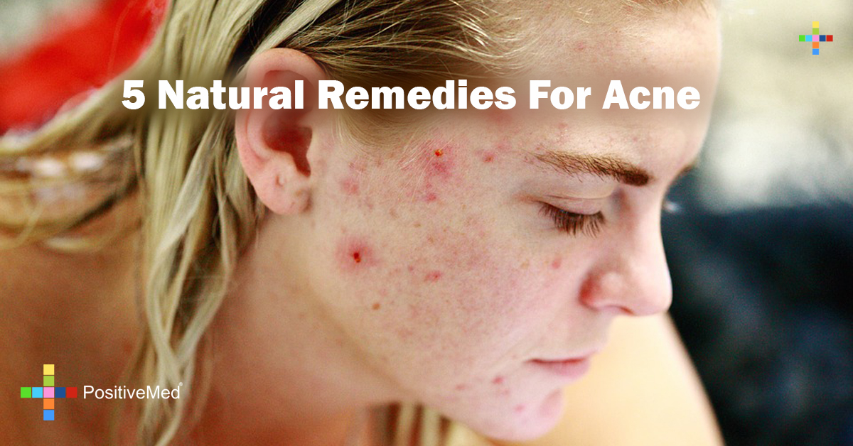 Natural Remedies For Acne