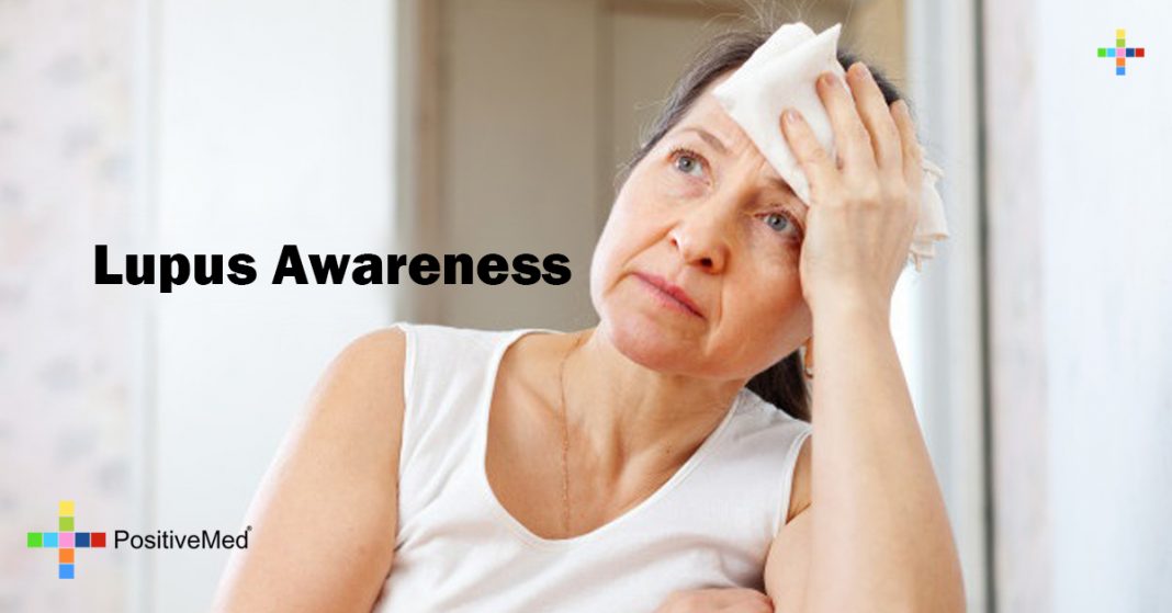 Lupus Awareness