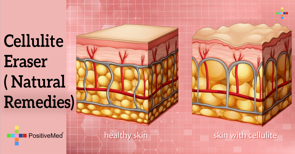 Cellulite Eraser With Natural Remedies and Juice Recipe