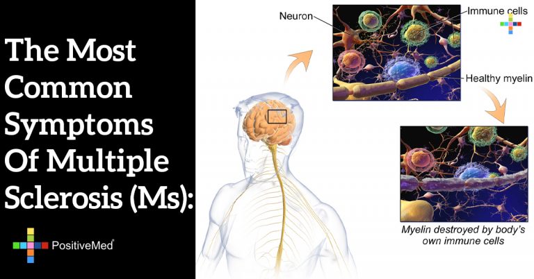 The most common symptoms of multiple sclerosis (MS): - PositiveMed